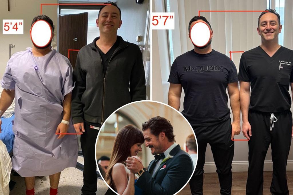 Leg-lengthening surgery from ‘Materialists’ is real — here’s why ...